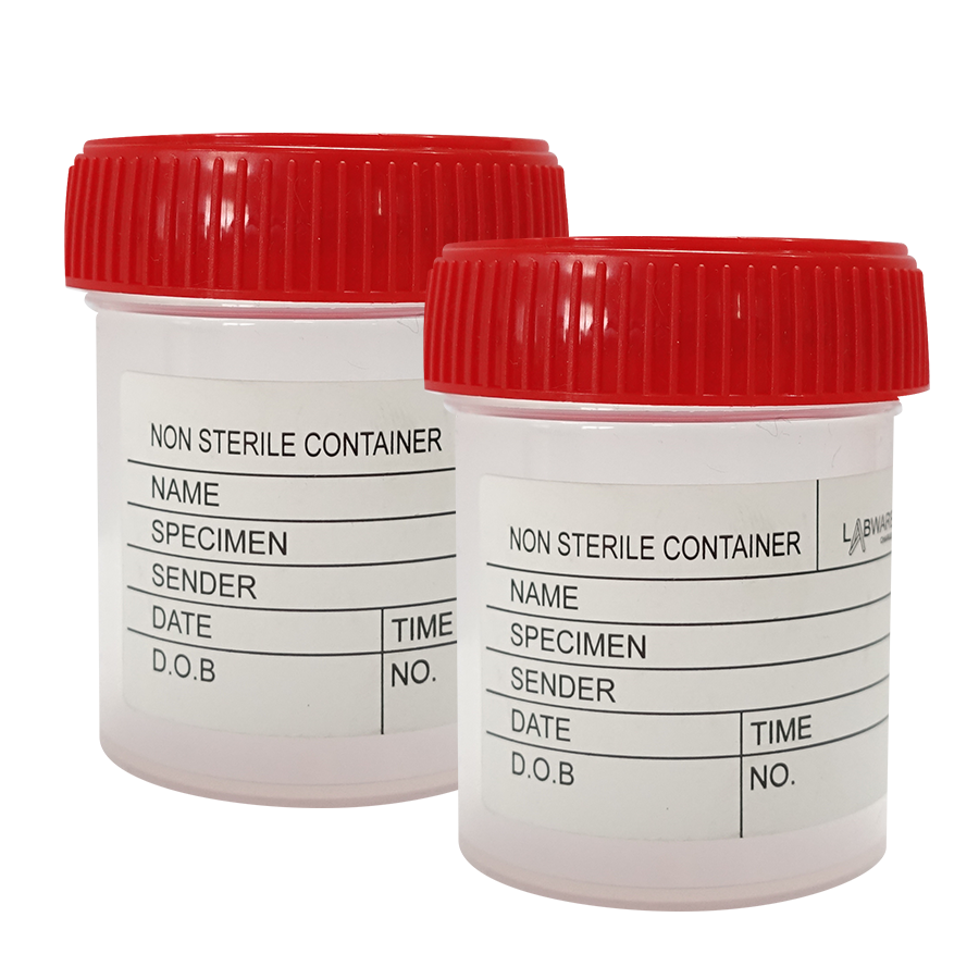 SPECIMEN CONTAINER 60 ML (NON STERILE) PS RED | Agarindo Biological Company