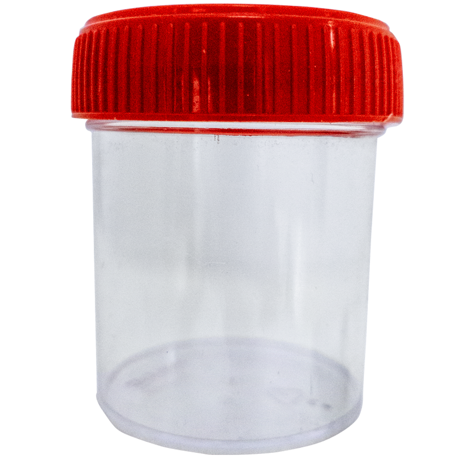 SPECIMEN CONTAINER 60 ML (NON STERILE) PS RED | Agarindo Biological Company
