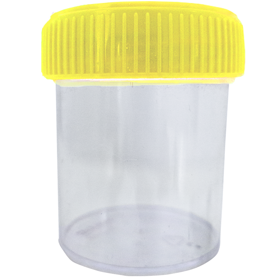 SPECIMEN CONTAINER 60 ML (NON STERILE) PS YELLOW | Agarindo Biological ...