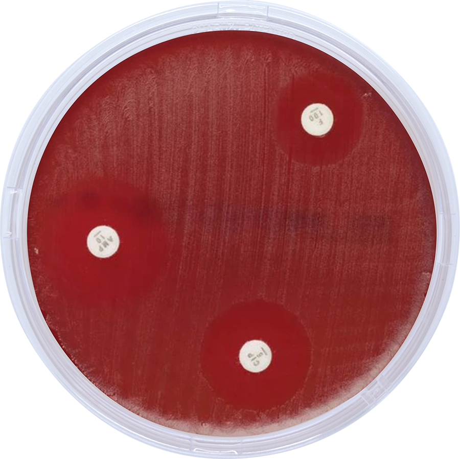 MUELLER HINTON AGAR WITH BLOOD | Agarindo Biological Company