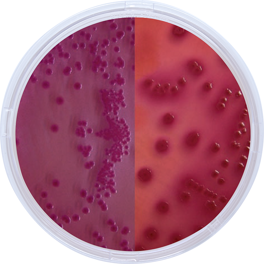 MACCONKEY AGAR | Agarindo Biological Company