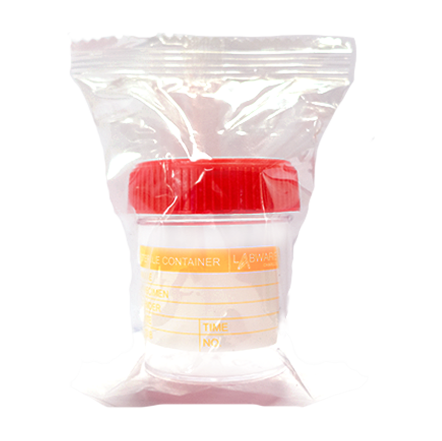 SPECIMEN CONTAINER 60 ML (STERILE) PS RED | Agarindo Biological Company