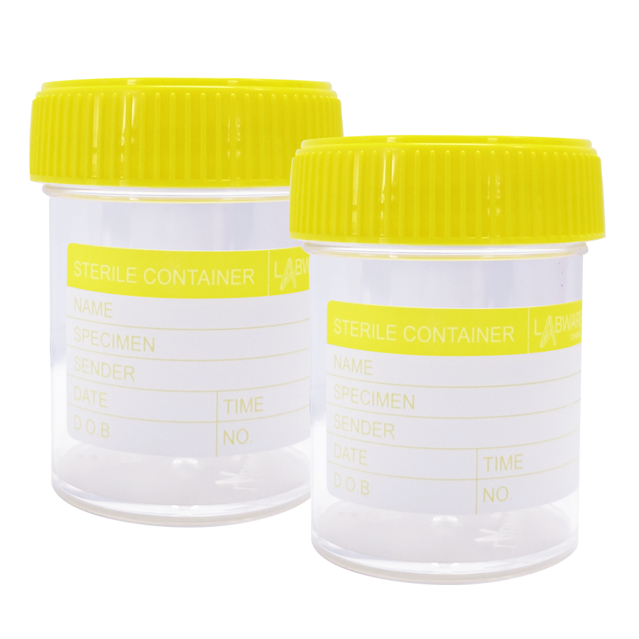SPECIMEN CONTAINER 60 ML (STERILE) PS YELLOW | Agarindo Biological Company